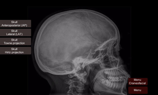 Download Radiographic Anatomy X-Ray for PC / MAC / Windows